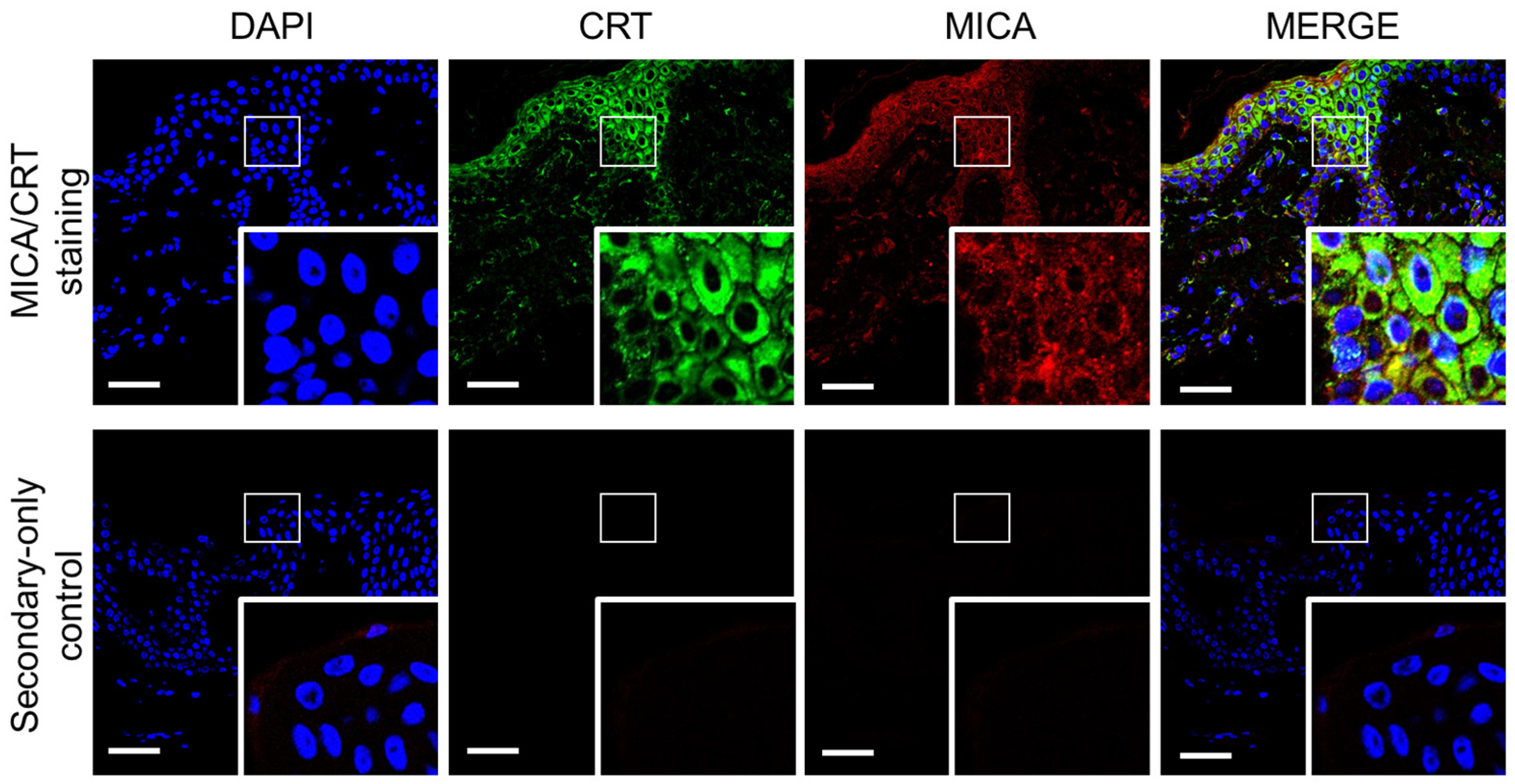 Calreticulin-Mediated Quality Control of the Non-Classical MHC-I ...
