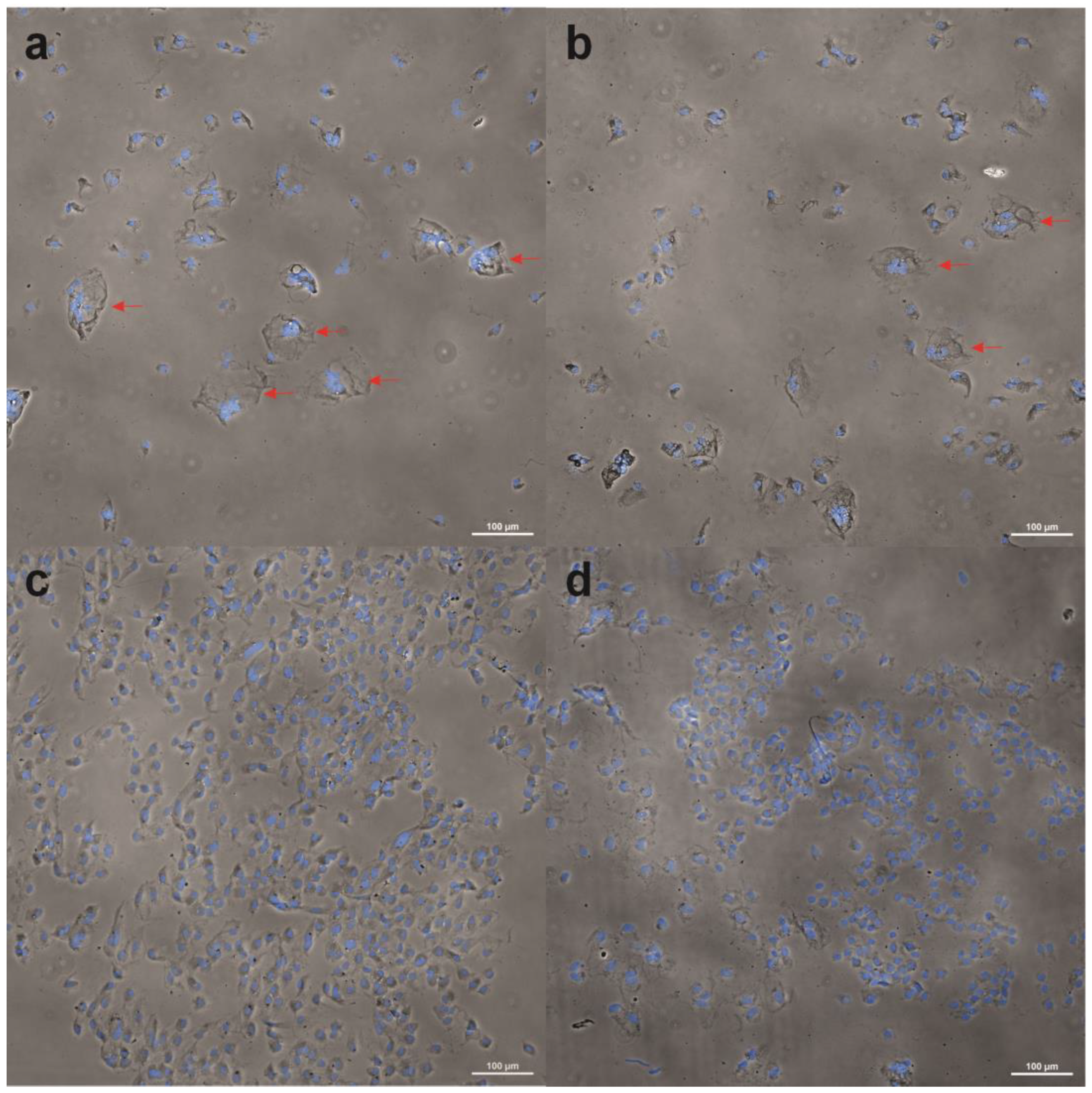 Functional Differences Between Typical and Multinucleated Endothelial ...