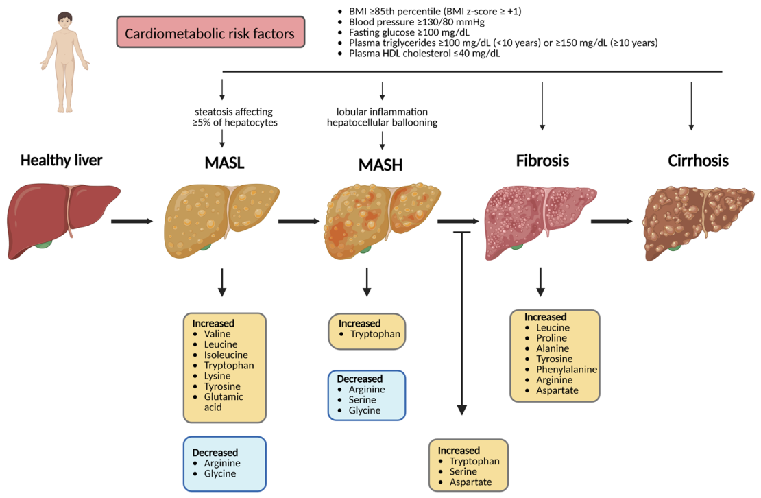 Amino Acids—Potential Biomarkers of Histological Features for MASLD in ...