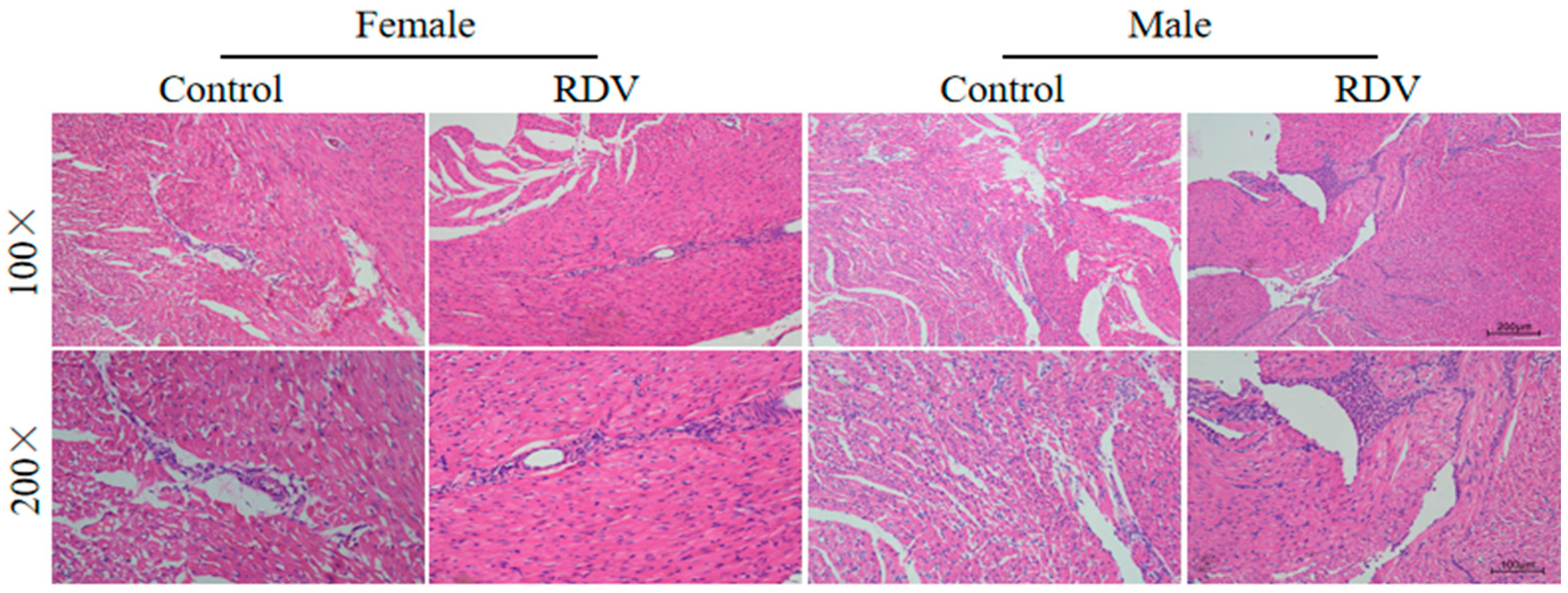 Electrophysiological and Molecular Features of Remdesivir-Induced ...