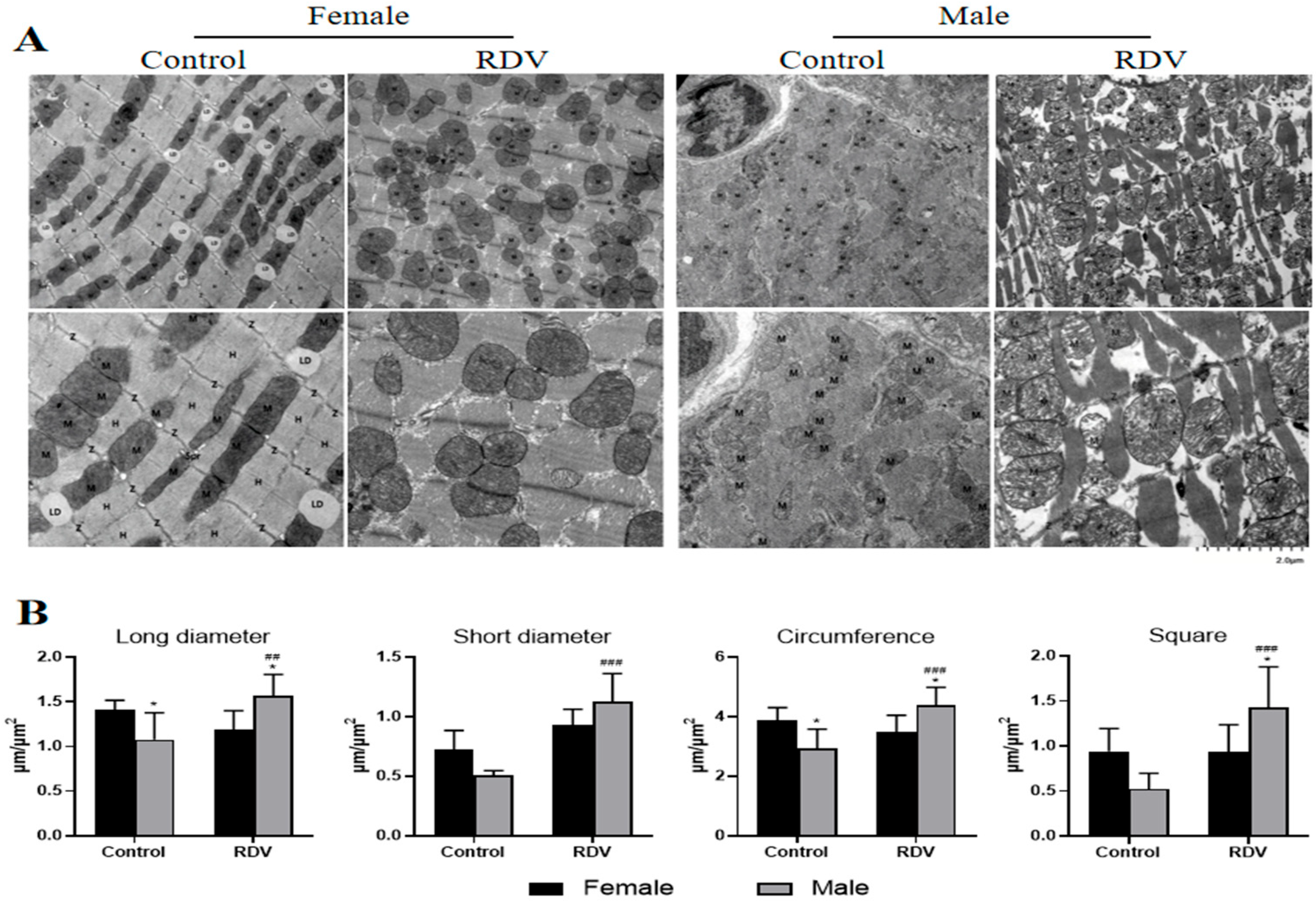 Electrophysiological and Molecular Features of Remdesivir-Induced ...