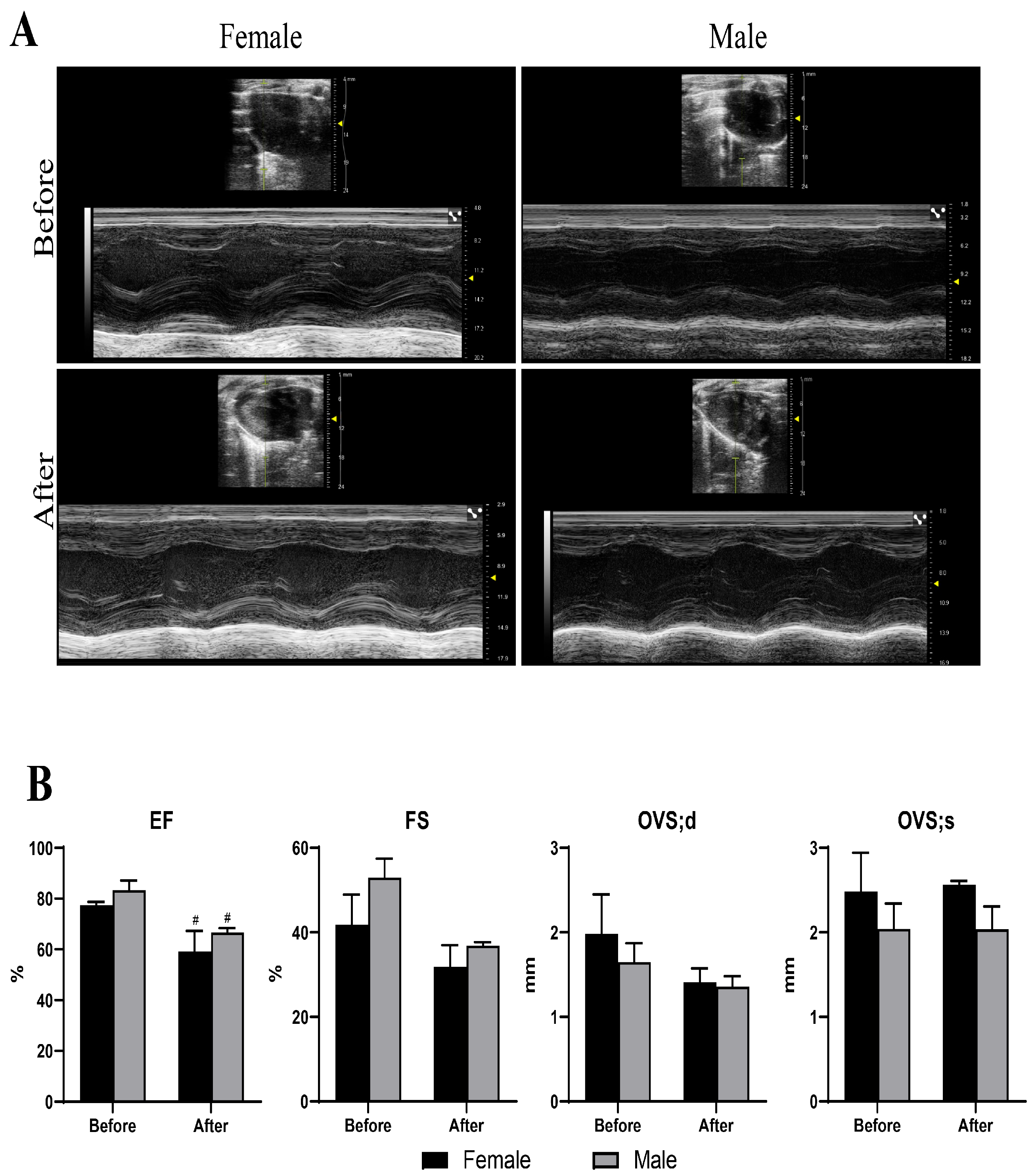 Electrophysiological and Molecular Features of Remdesivir-Induced ...