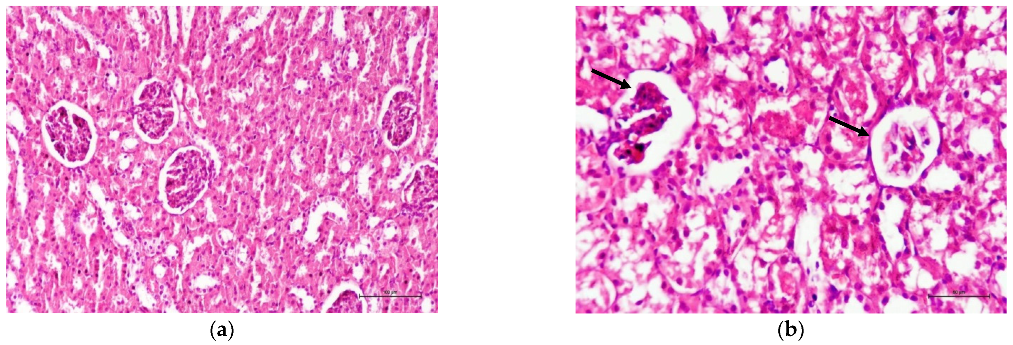 The Protective Effects of N-Acetylserotonin Against Cisplatin-Induced ...