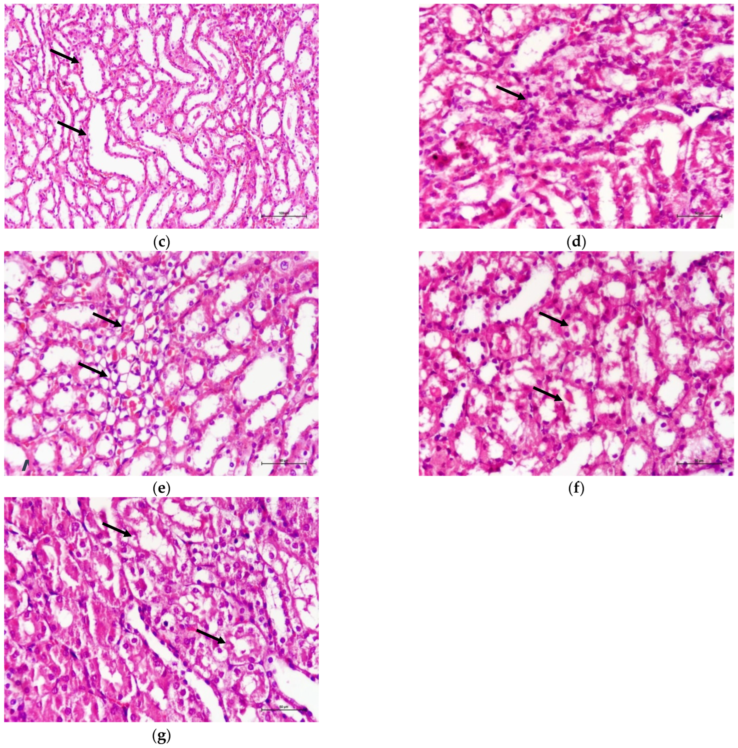 The Protective Effects of N-Acetylserotonin Against Cisplatin-Induced ...