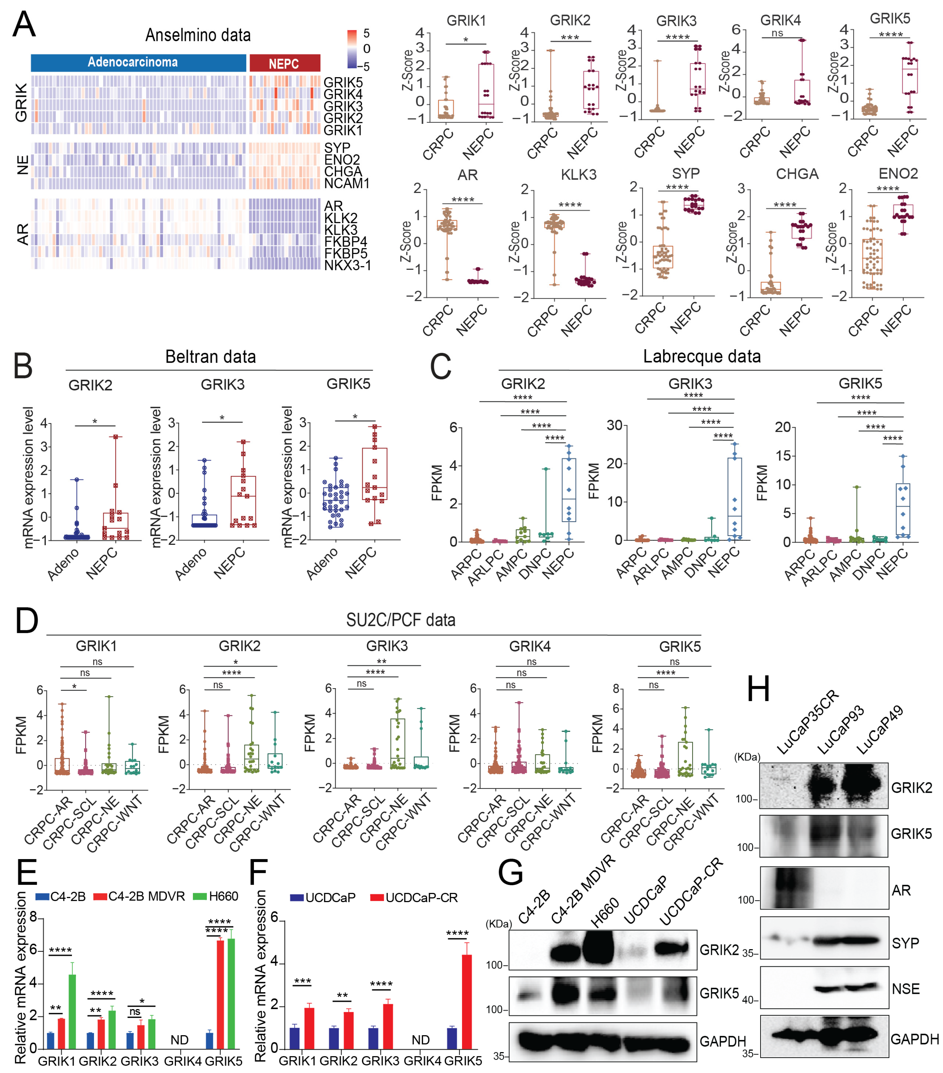 Glutamate Ionotropic Kainate Receptors as Therapeutic Targets in ...
