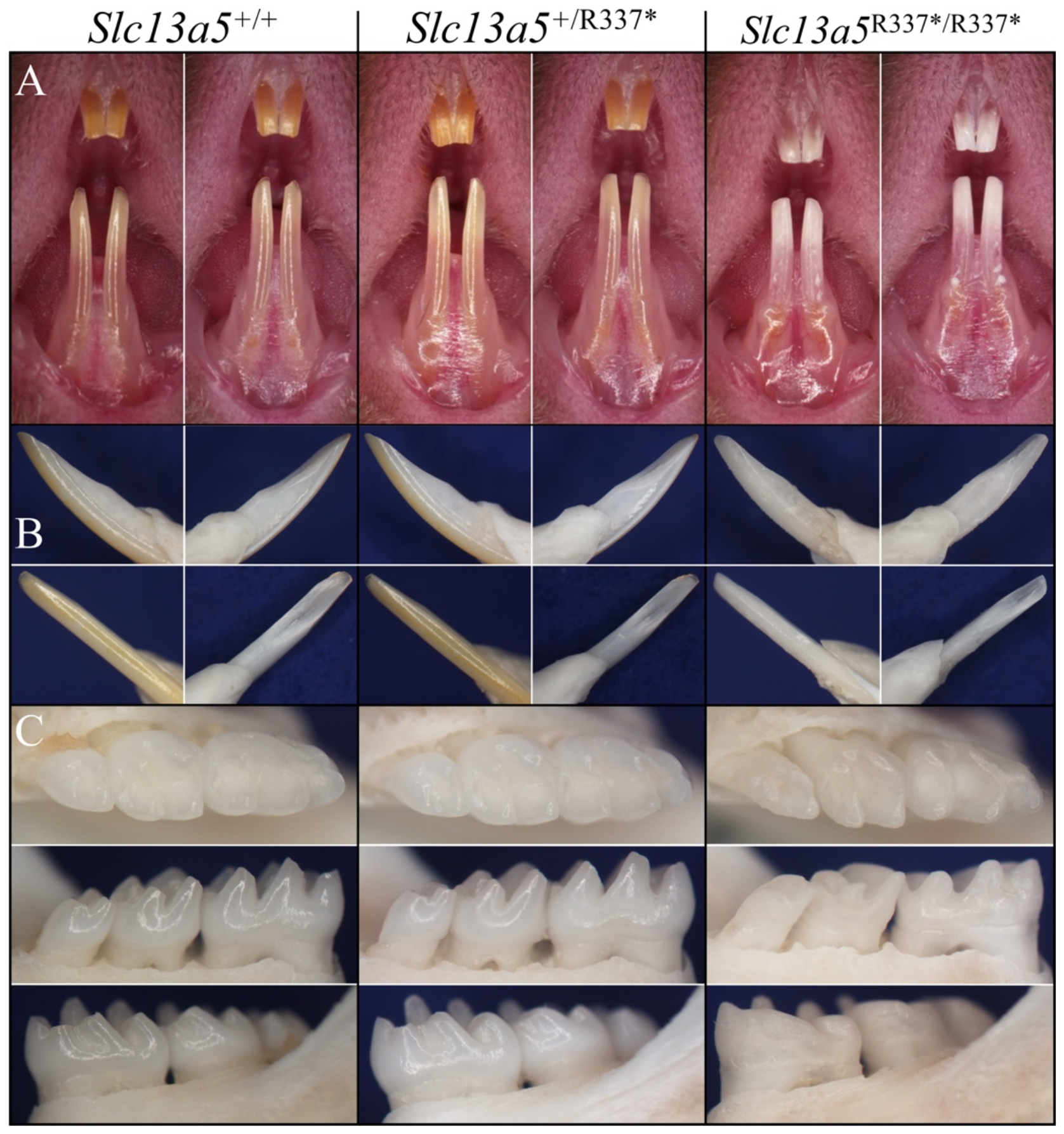 Citrate Transporter NaCT and Enamel Mineralization: The Slc13a5R337 ...