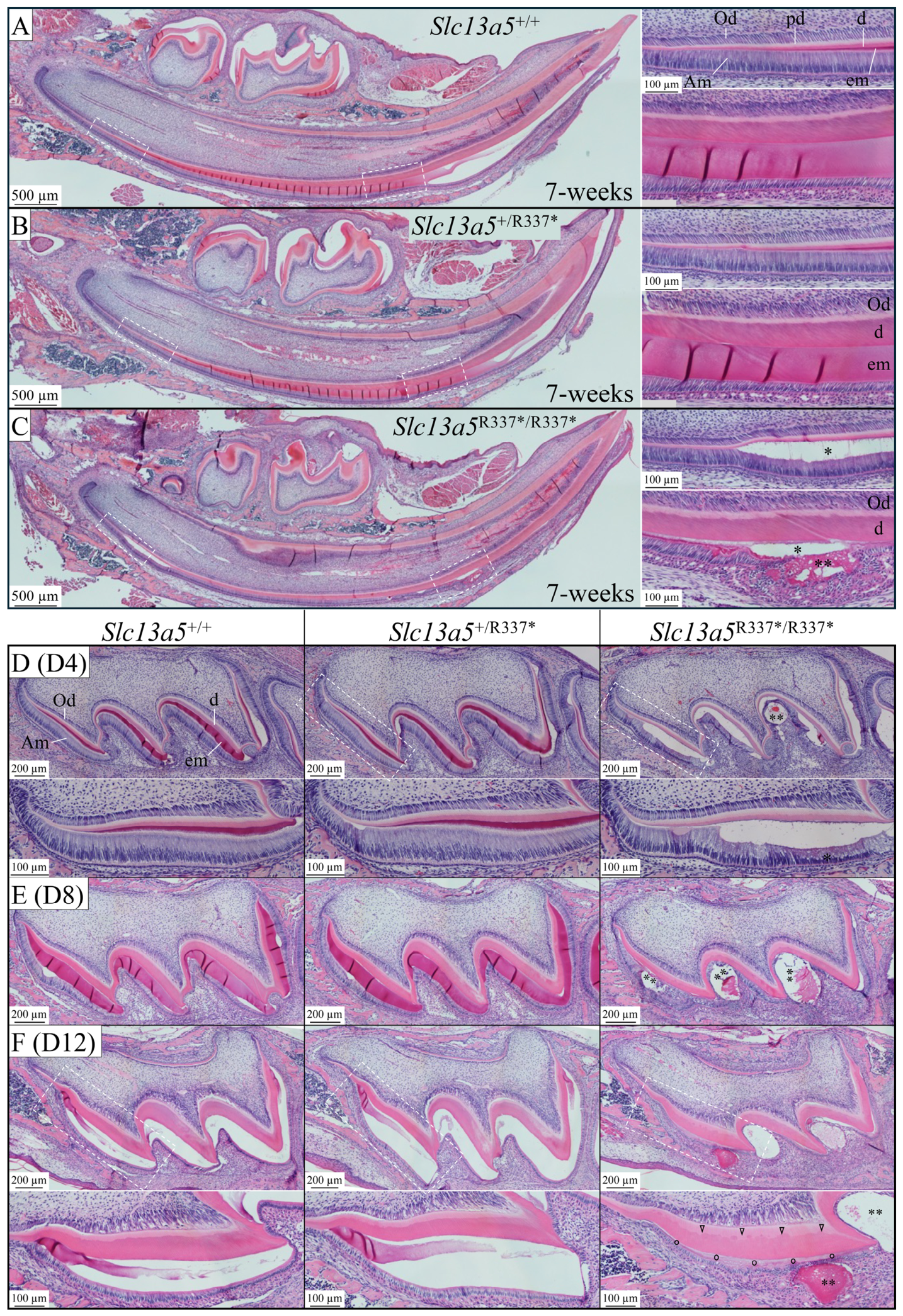 Citrate Transporter NaCT and Enamel Mineralization: The Slc13a5R337 ...