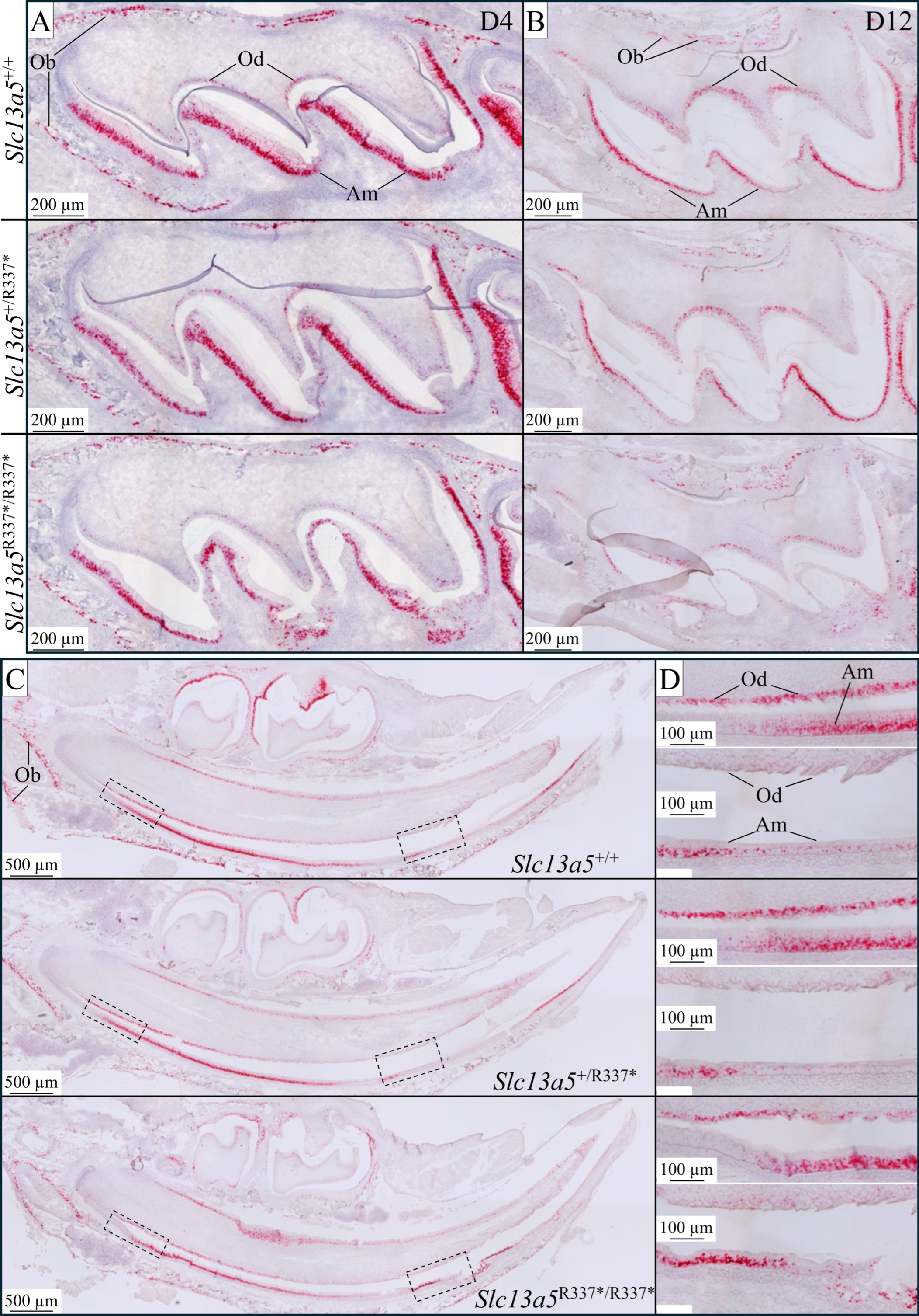 Citrate Transporter NaCT and Enamel Mineralization: The Slc13a5R337 ...