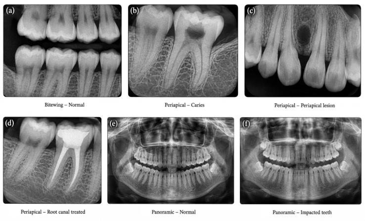 An Attention-Enhanced Deep Learning Framework for Multi-Label Dental ...
