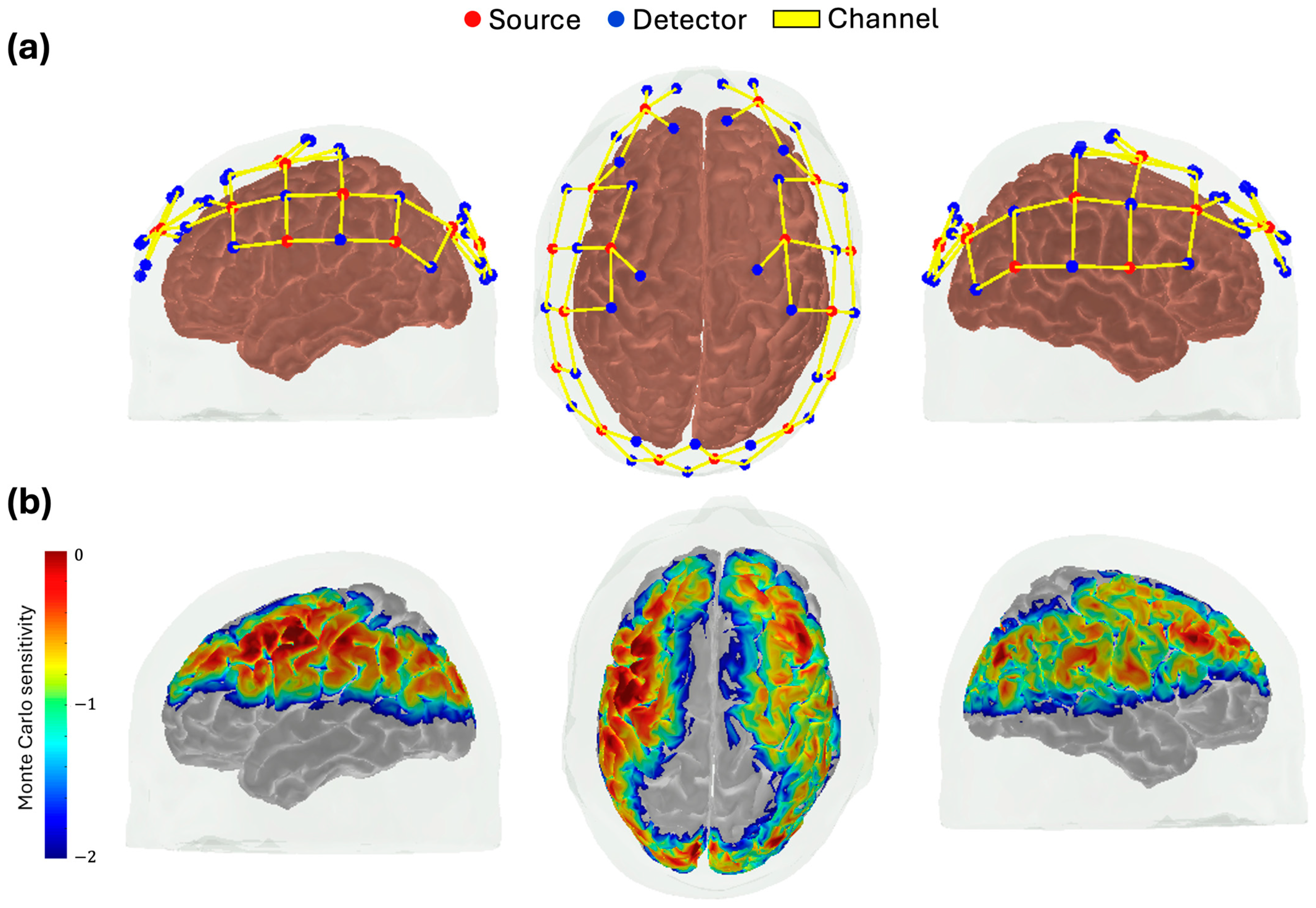 Graph Analysis of Age-Related Changes in Resting-State Functional ...
