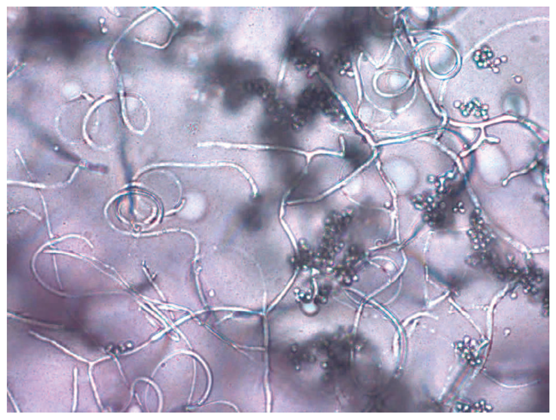 Isolation of Dermatophytes (and Other Fungi) from Human Nail and Skin ...