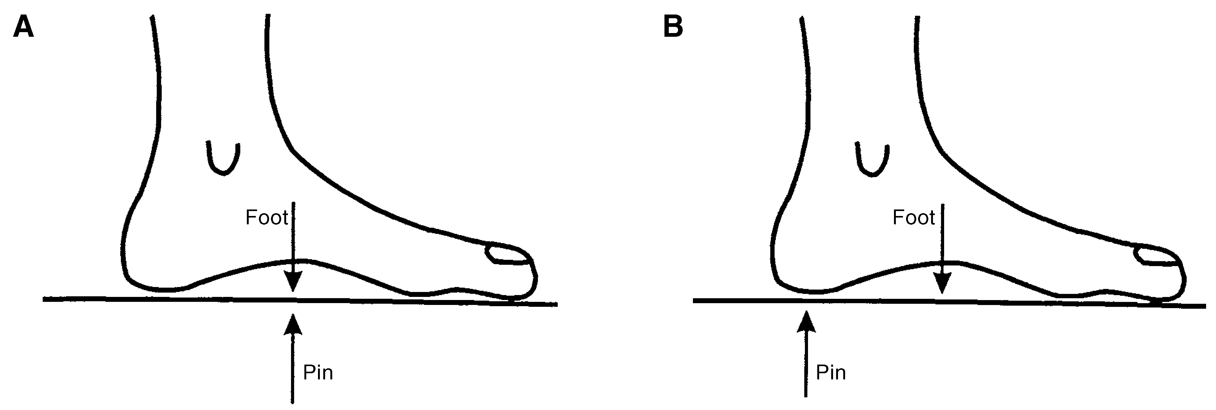 Center of pressure and its theoretical relationship to foot pathology