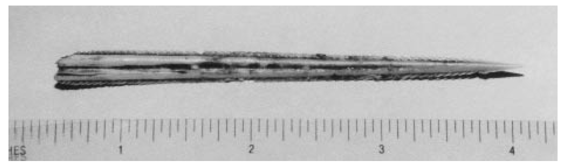 Treatment of stingray injury with topical becaplermin gel