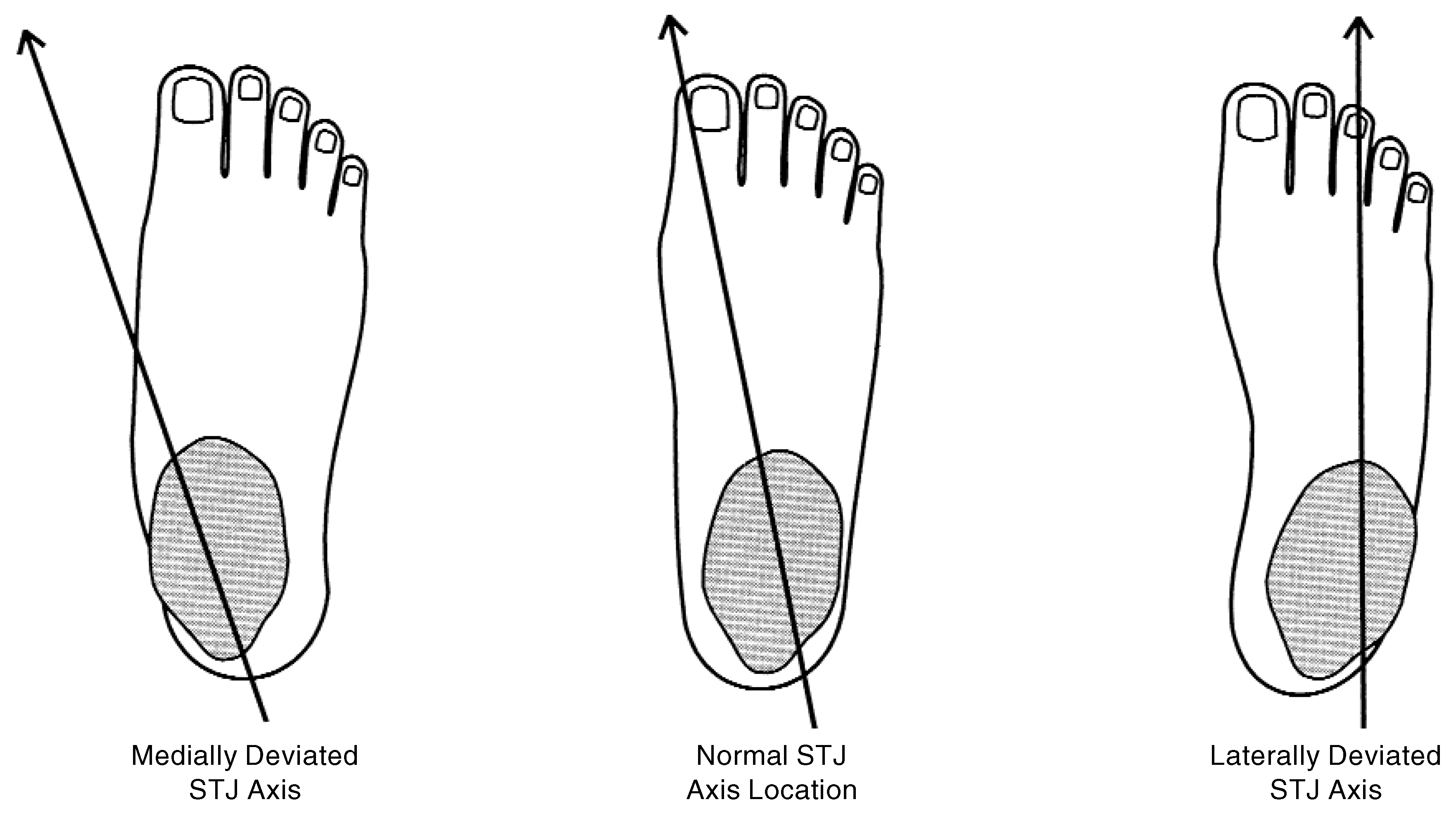 Biomechanics of the normal and abnormal foot