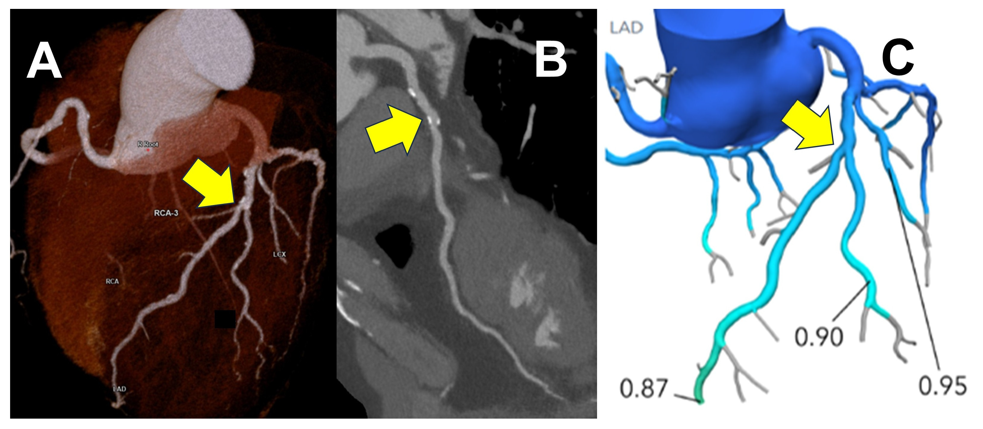 Cardiac Computed Tomography: Technological Developments and Clinical ...