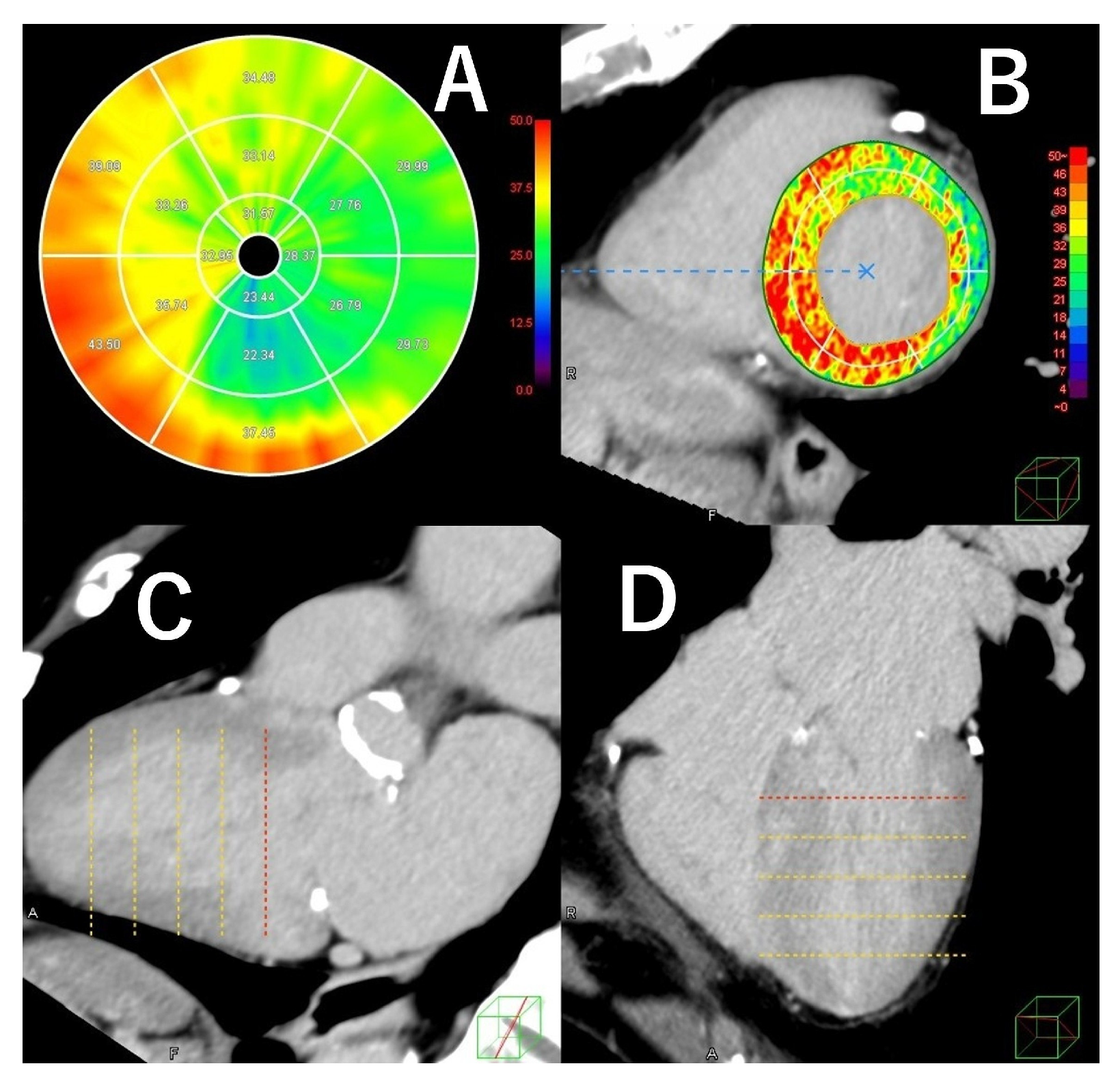 Cardiac Computed Tomography: Technological Developments and Clinical ...