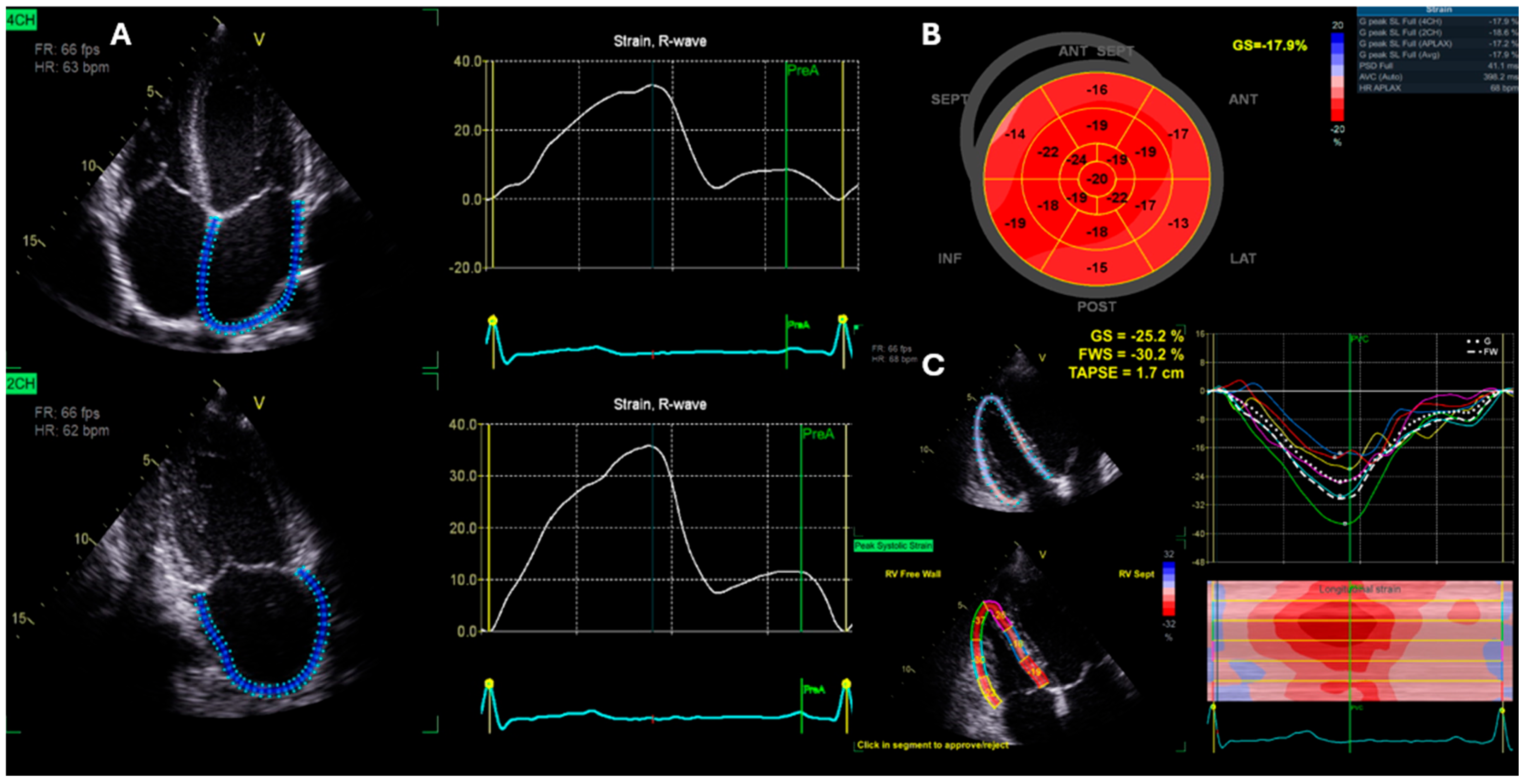 Phenotyping the Structure and Function of the Heart of Elite Sailors ...