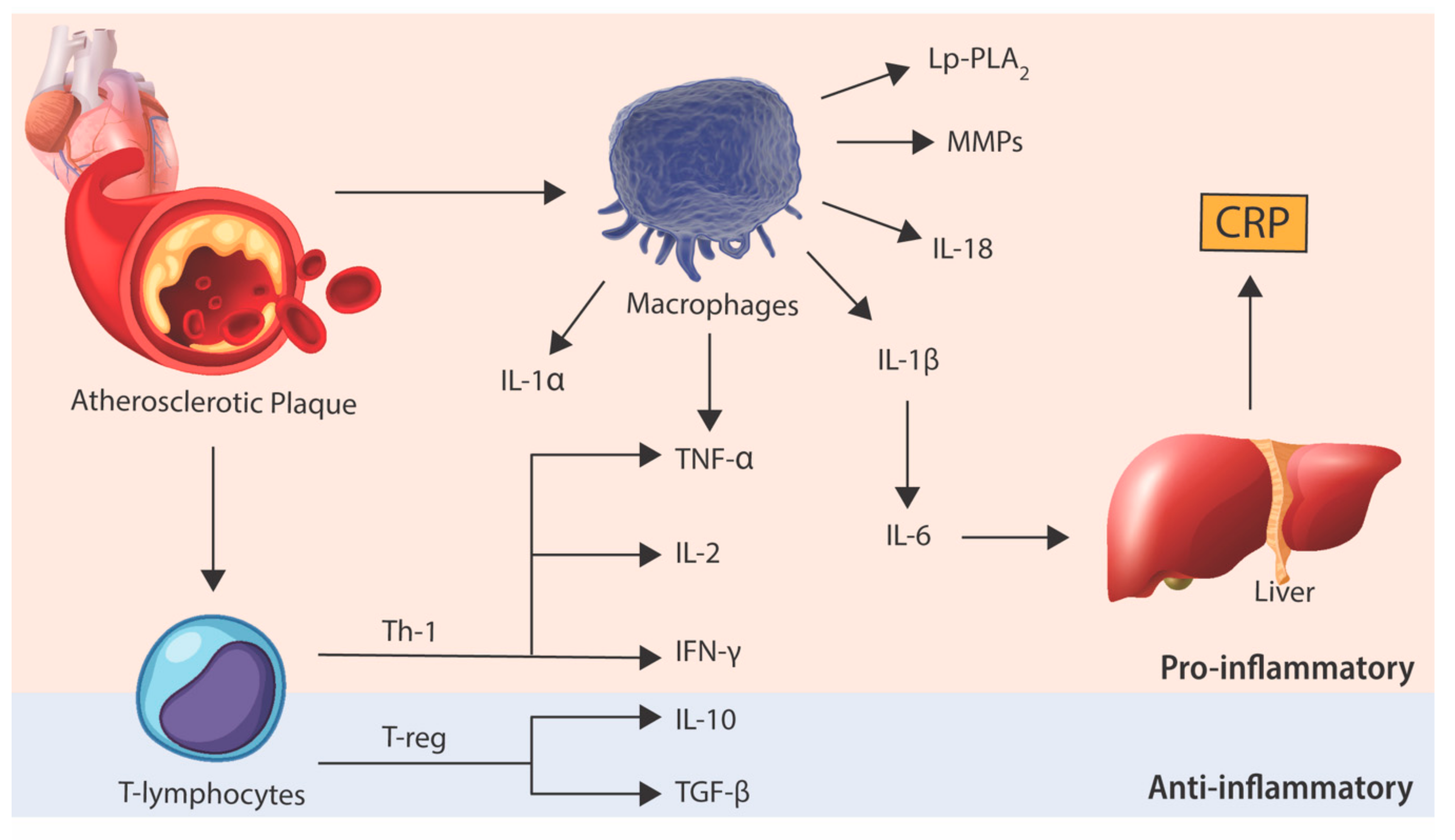 JCM Free Full Text Inflammation As A Therapeutic Target In JCM Free Full Text Inflammation As A Therapeutic Target In