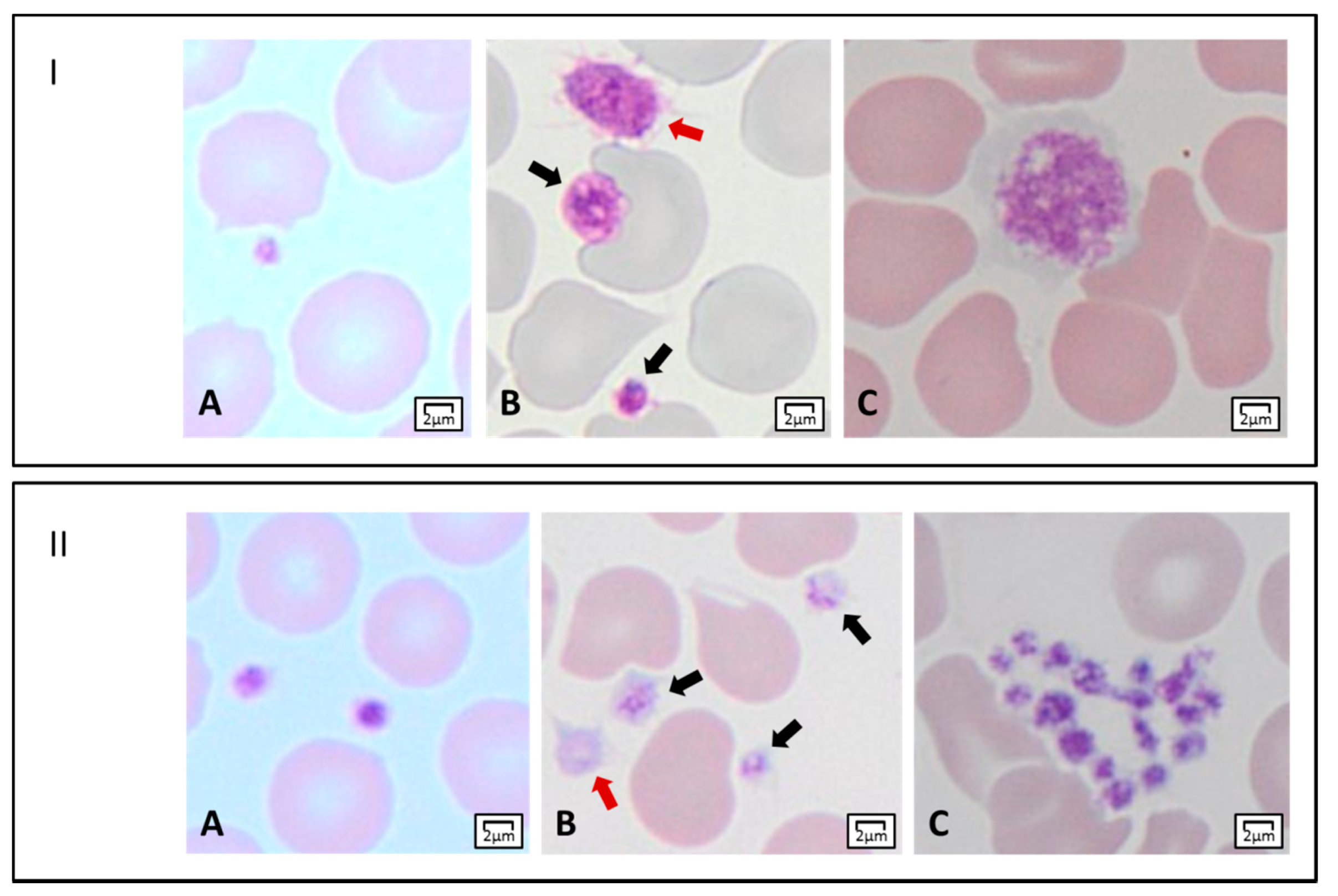 Diagnosis Of Inherited Platelet Disorders On A Blood Smear Diagnosis Of Inherited Platelet Disorders On A Blood Smear