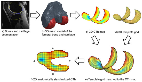 Analyzing Femorotibial Cartilage Thickness Using Anatomically ...