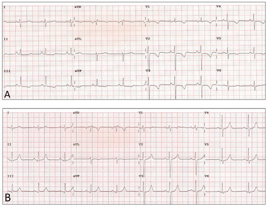 JCM | Free Full-Text | Assessment of Clinical Usefulness of Resting ...