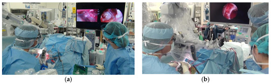 Preliminary Clinical Surgical Experience with Temporary Simultaneous ...