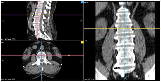 Comparison of the Classification Results Accuracy for CT Soft Tissue ...