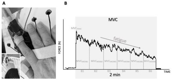 Hand Motor Fatigability Induced by a Simple Isometric Task in Spinal ...