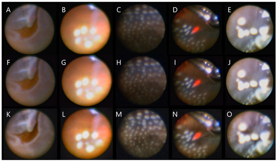 Effects of Image Processing Using Honeycomb-Removal and Image ...