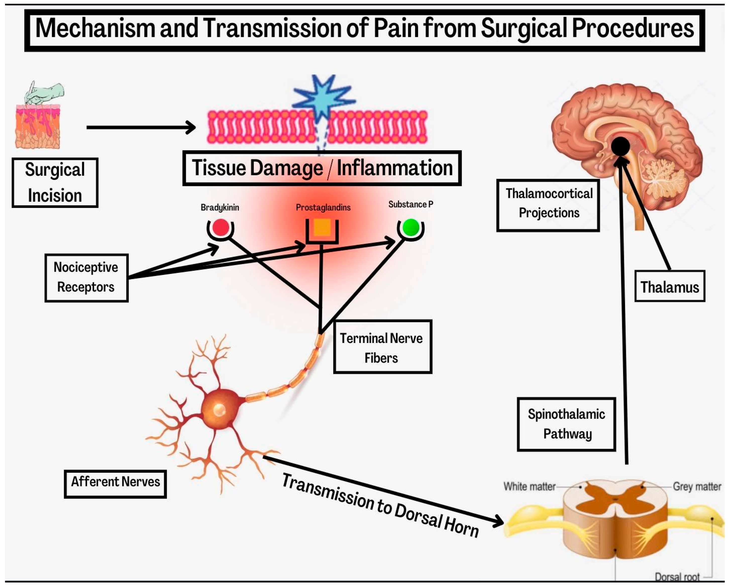 Multimodal Pain Management In Orthopedic Surgery Multimodal Pain Management In Orthopedic Surgery