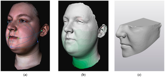 Reliability of 3D Stereophotogrammetry for Measuring Postoperative ...