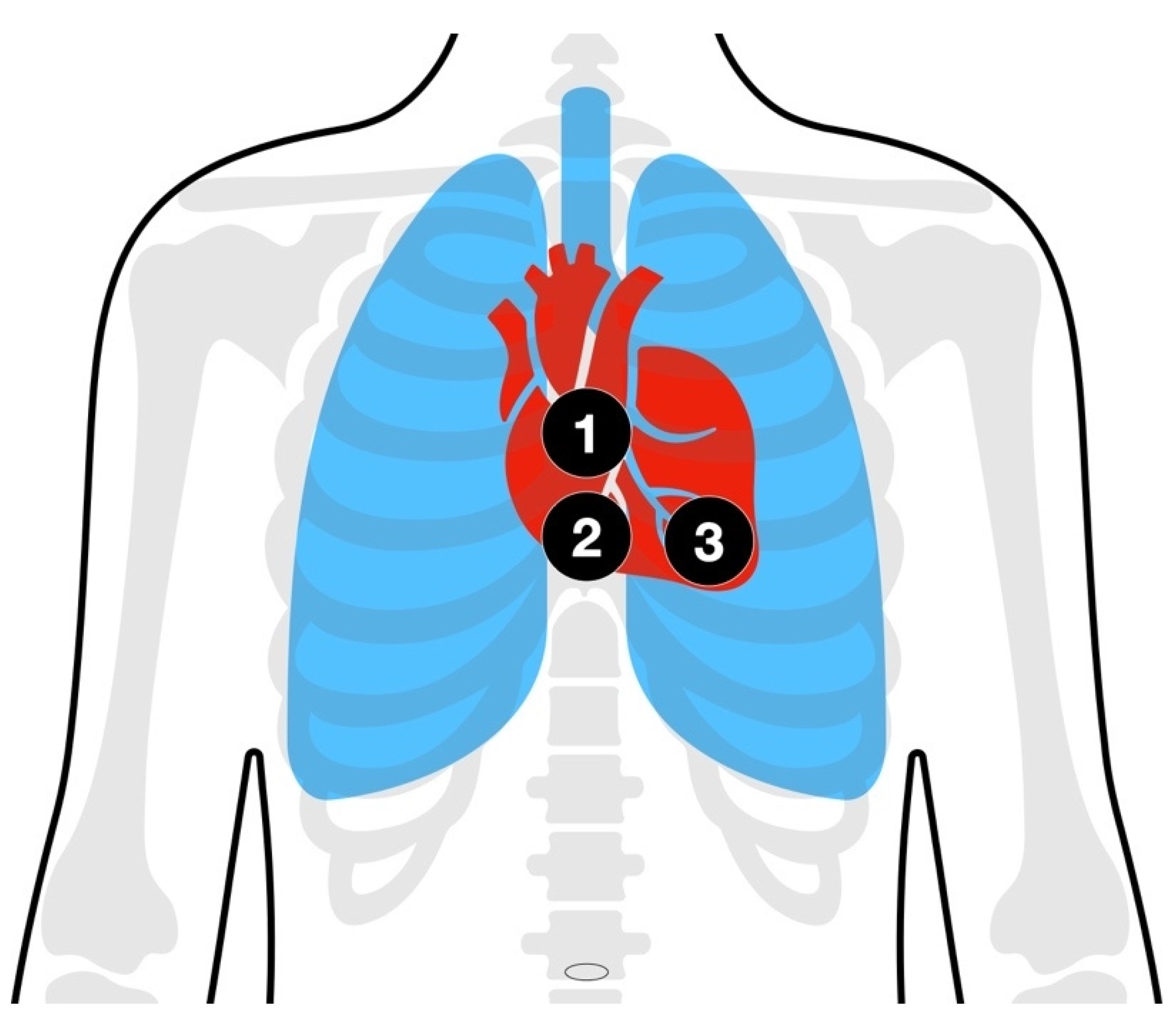 JCM Free Full Text Advanced And Invasive Cardiopulmonary JCM Free Full Text Advanced And Invasive Cardiopulmonary