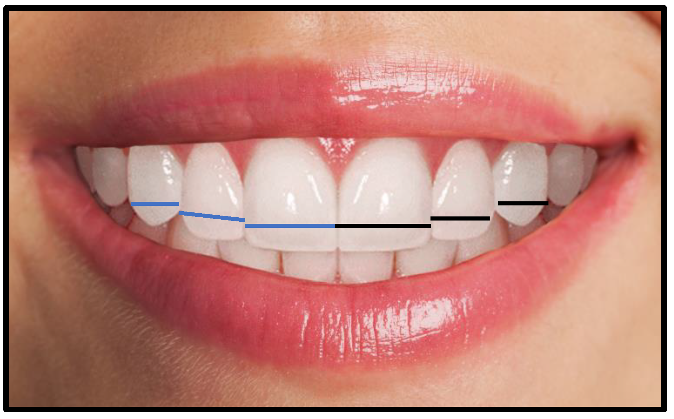 Dental Anatomy Reference Guide Blue Dolphin Products 54 OFF Dental Anatomy Reference Guide Blue Dolphin Products 54 OFF