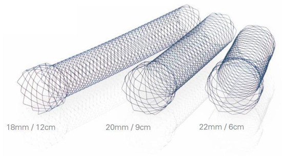 JCM | Free Full-Text | Gastroduodenal Stenting with a Flexible Stent ...