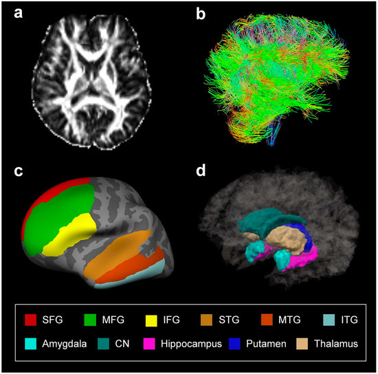 Increased Hippocampal-Inferior Temporal Gyrus White Matter Connectivity ...