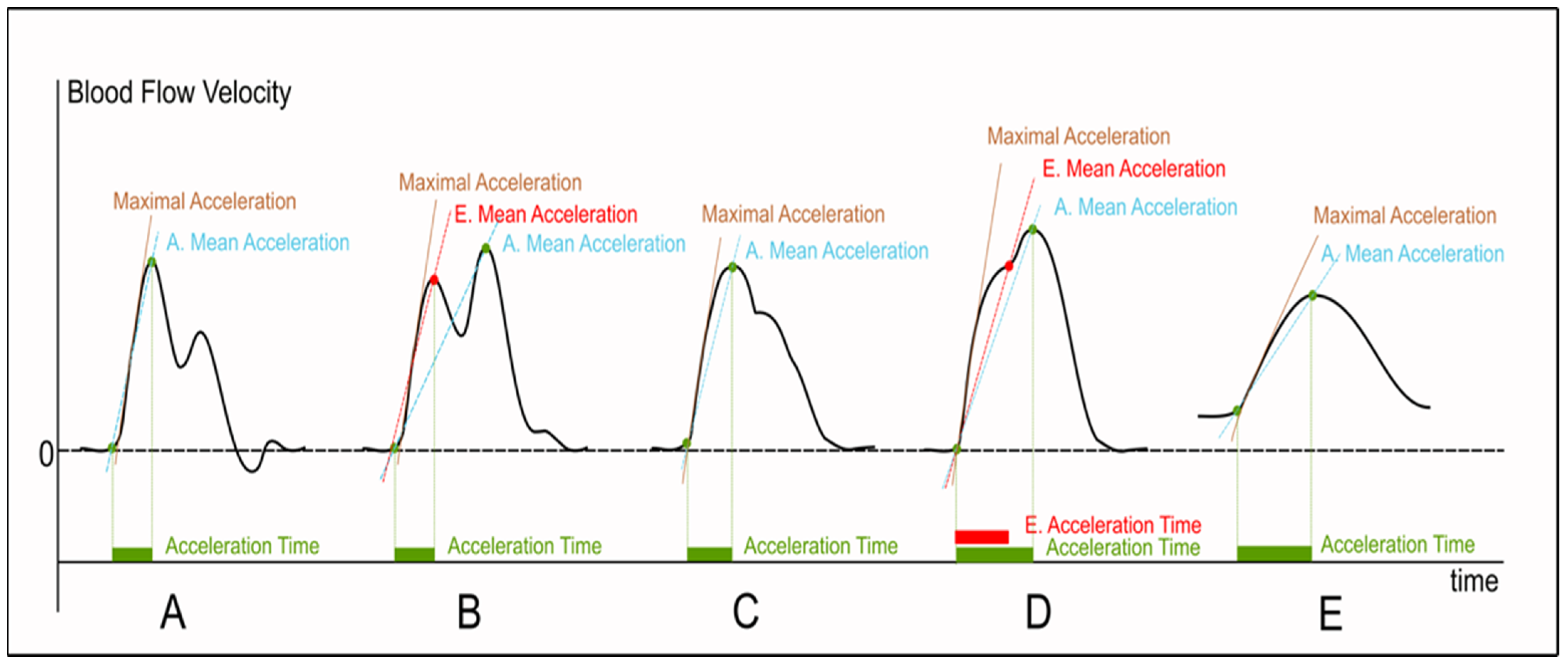 JCM Free Full Text Arterial Blood Flow Acceleration Time On Doppler JCM Free Full Text Arterial Blood Flow Acceleration Time On Doppler