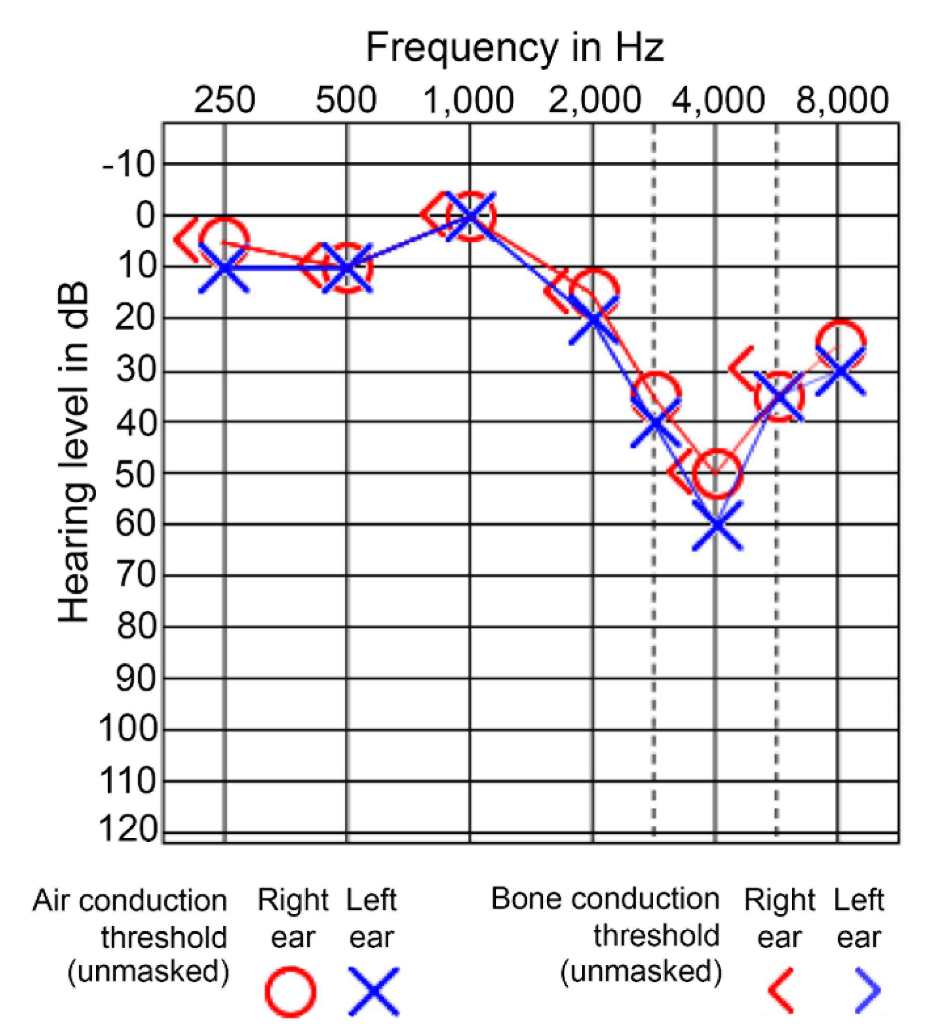 Nihl Audiogram Nihl Audiogram