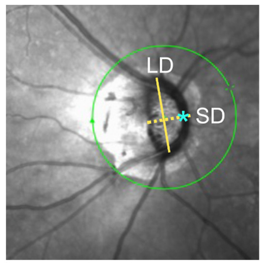Optic Disc In Dots