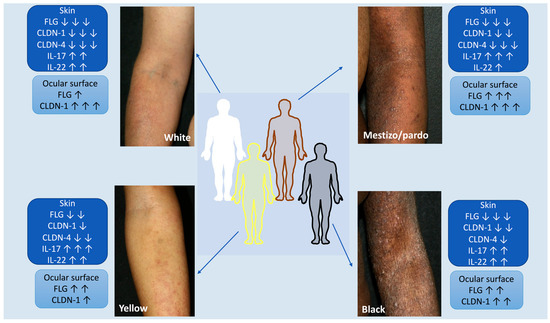 JCM | Special Issue : Ethnic Differences in Dermatitis and Atopic ...