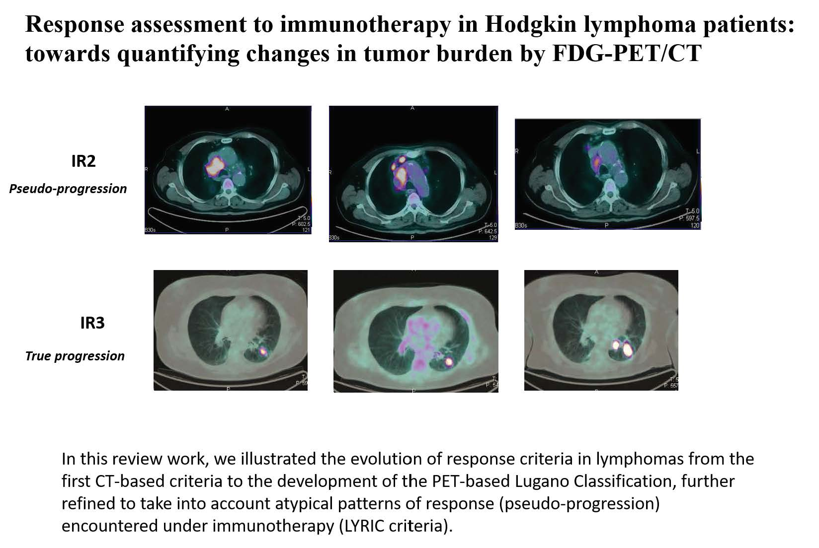 JCM Free Full Text Assessment Of Response To Immunotherapy In JCM Free Full Text Assessment Of Response To Immunotherapy In