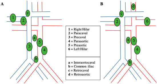 The Current Role of Lymph Node Dissection in Nonmetastatic Localized ...
