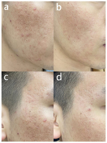 JCM | Special Issue : Medical Cosmetic Skin Diseases: Starting from ...