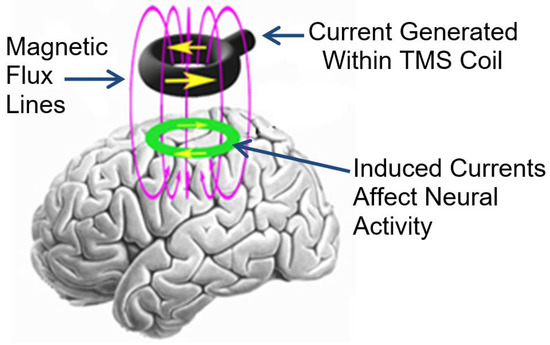 JCM | Free Full-Text | Unresolved Issues Associated with Transcranial ...