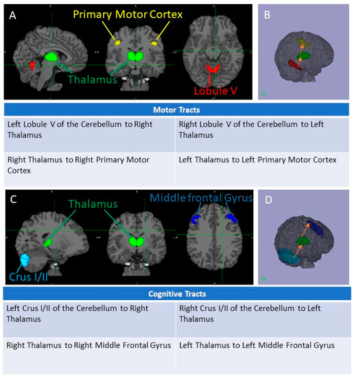 JCM | Free Full-Text | Increased Cerebello-Prefrontal Connectivity ...