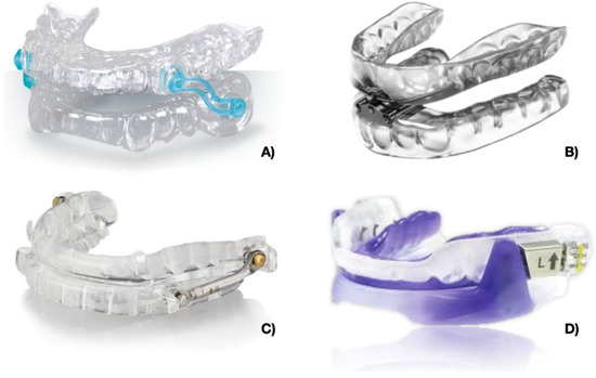 JCM | Free Full-Text | Upper Airway Characteristics and Morphological ...
