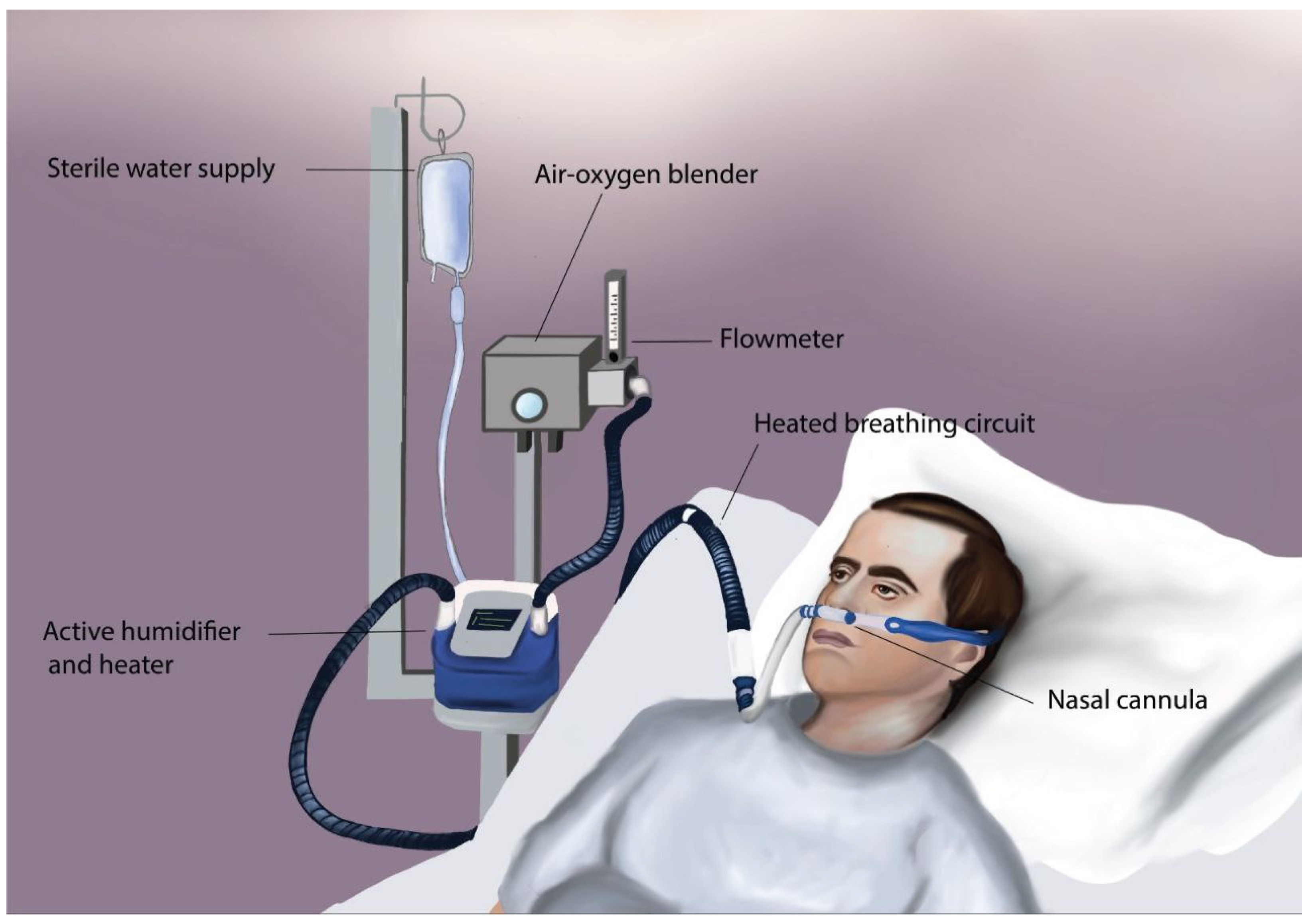 JCM Free Full Text High Flow Oxygen Therapy In The Perioperative JCM Free Full Text High Flow Oxygen Therapy In The Perioperative