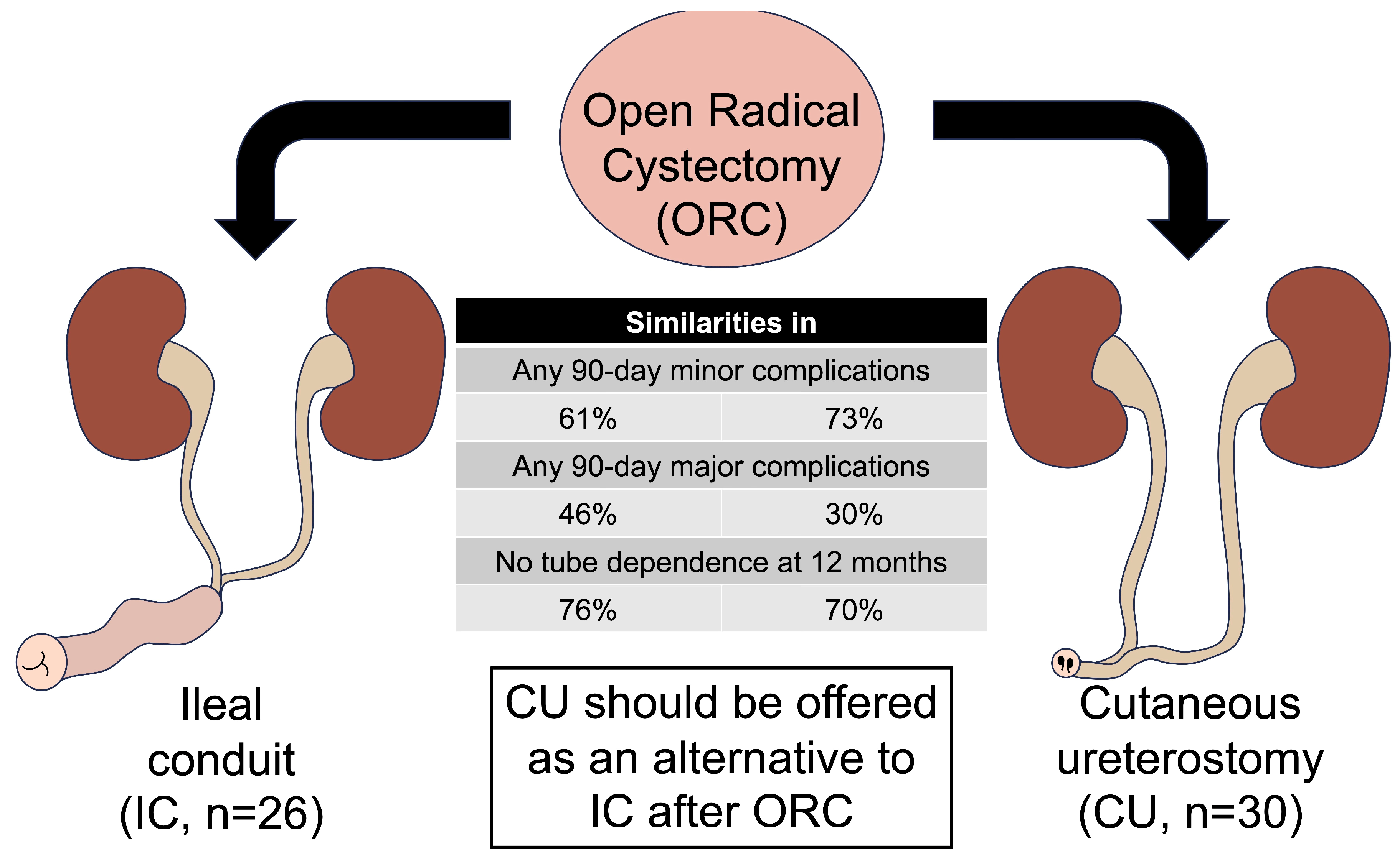 Ureterostomy Tube Ureterostomy Tube