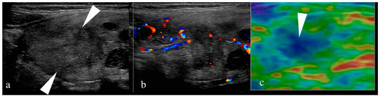 Comprehensive Review of the Imaging Recommendations for Diagnosis ...