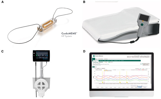 Use of the CardioMEMS Device in Children and Patients with Congenital ...