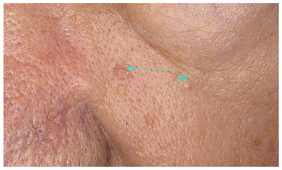 Should the Dermatological Assessment of Patients with Inflammatory ...